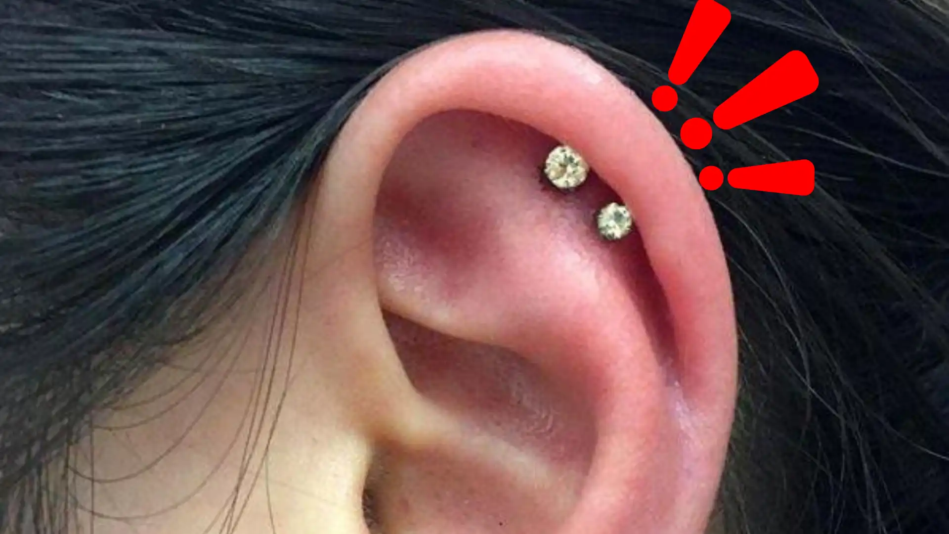 Helix Piercing Care: Understanding Bumps, Causes,